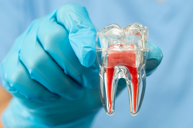 Root Canal Treatment Florham Park, NJ | DDG Florham Park